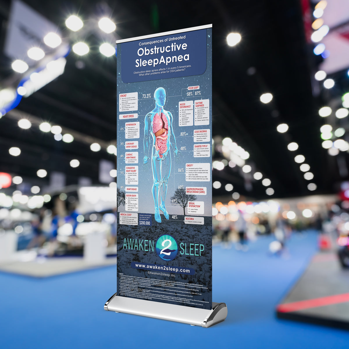 Consequences of Untreated OSA Pop Up Banner – Judson Design and Print